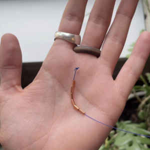 GyneFix: Everything you need to know - The Lowdown