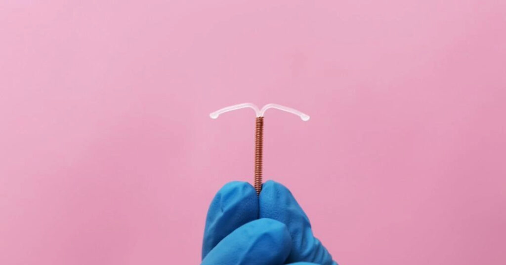 Can I remove my IUD at home? | The Lowdown
