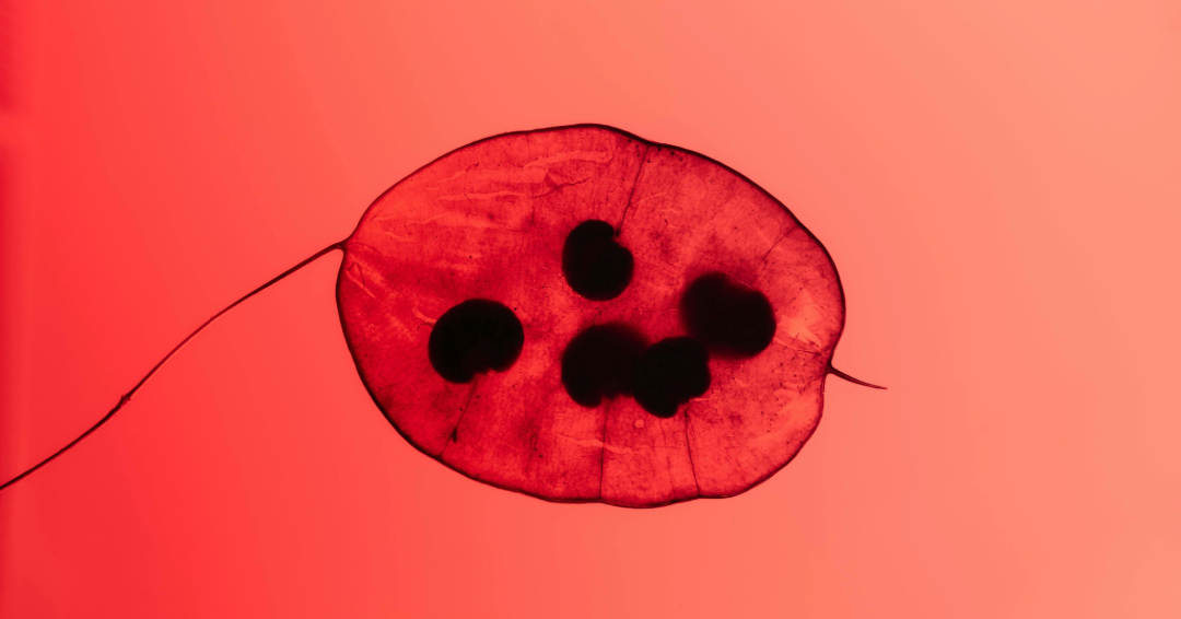 What is a Decidual Cast? - The Lowdown